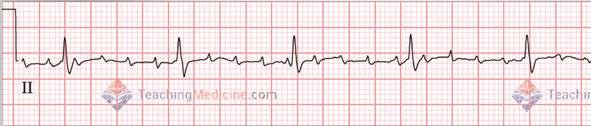 Teaching Medicine Tutorial Rhythm Diagnostic Criteria